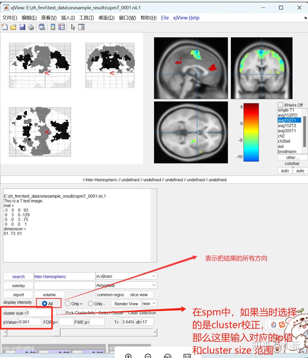 15（1）-SPM-fmri任务态 结果查看与汇报 xjview - 知乎