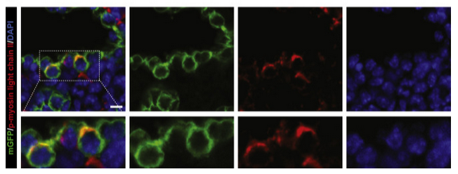 241021 文献泛读 AT2 / AT1 - 知乎