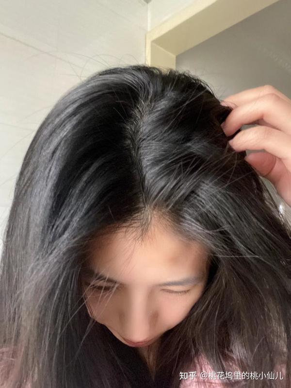 头发白转黑真的可以吗？有真实案例吗？ 知乎