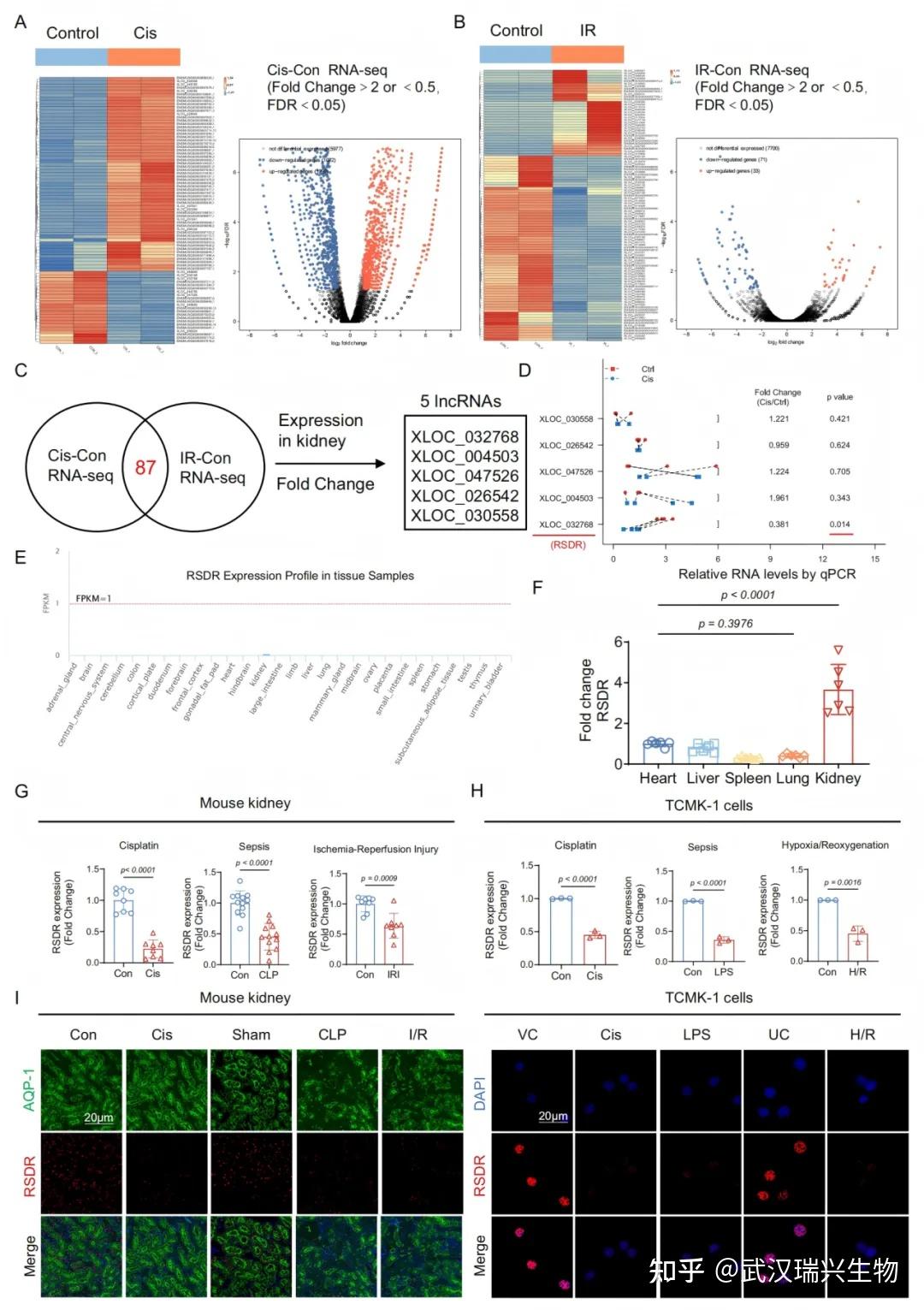 ChIRP项目文章 | Nature子刊揭示lncRNA阻遏hnRNPK核输出抗肾损伤新机制 - 知乎
