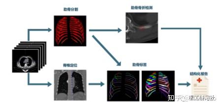 医学影像AI大盘点：CT篇 - 知乎