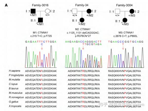 国内FEVR疾病研究团队发现新致病基因 - 知乎