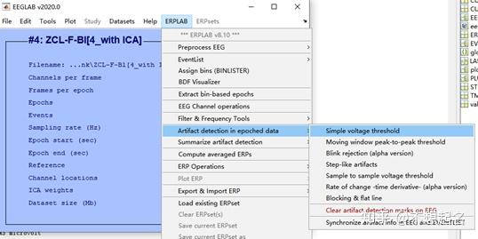 基于Matlab EEGLAB（ERPLAB）工具箱的脑电EEG分析教程 - 知乎