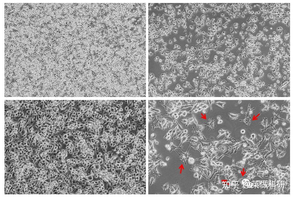 细胞因子诱导BV2小鼠胶质细胞活化细胞模型怎么做？ - 知乎