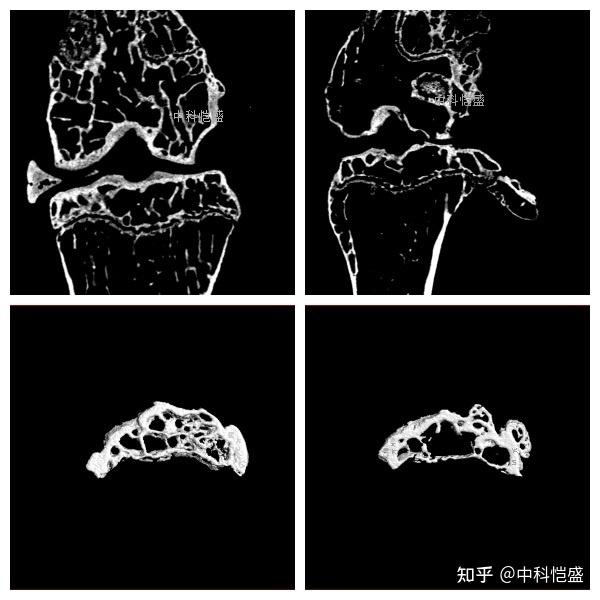 Micro-CT 在关节炎研究的应用-膝关节 - 知乎
