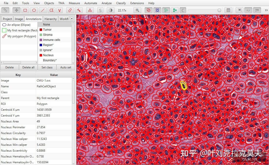 开源科学工程技术软件介绍41 – 生物图像分析软件QuPath - 知乎