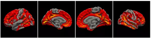 freesurfer学习：ROI Volume to Surface空间变换提取数据 - 知乎