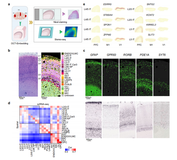 Nat Commun | 成年猕猴大脑皮层空间分辨基因调控和疾病易感性图谱 - 知乎