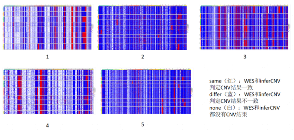 如虎添翼丨新格元scRNA联合WES分析助力肿瘤CNV研究 - 知乎