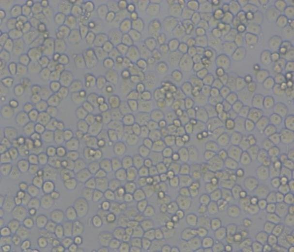 IPHASE/汇智和源原代肝细胞助力药物酶诱导研究 - 知乎