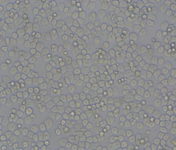 IPHASE/汇智和源原代肝细胞助力药物酶诱导研究 - 知乎