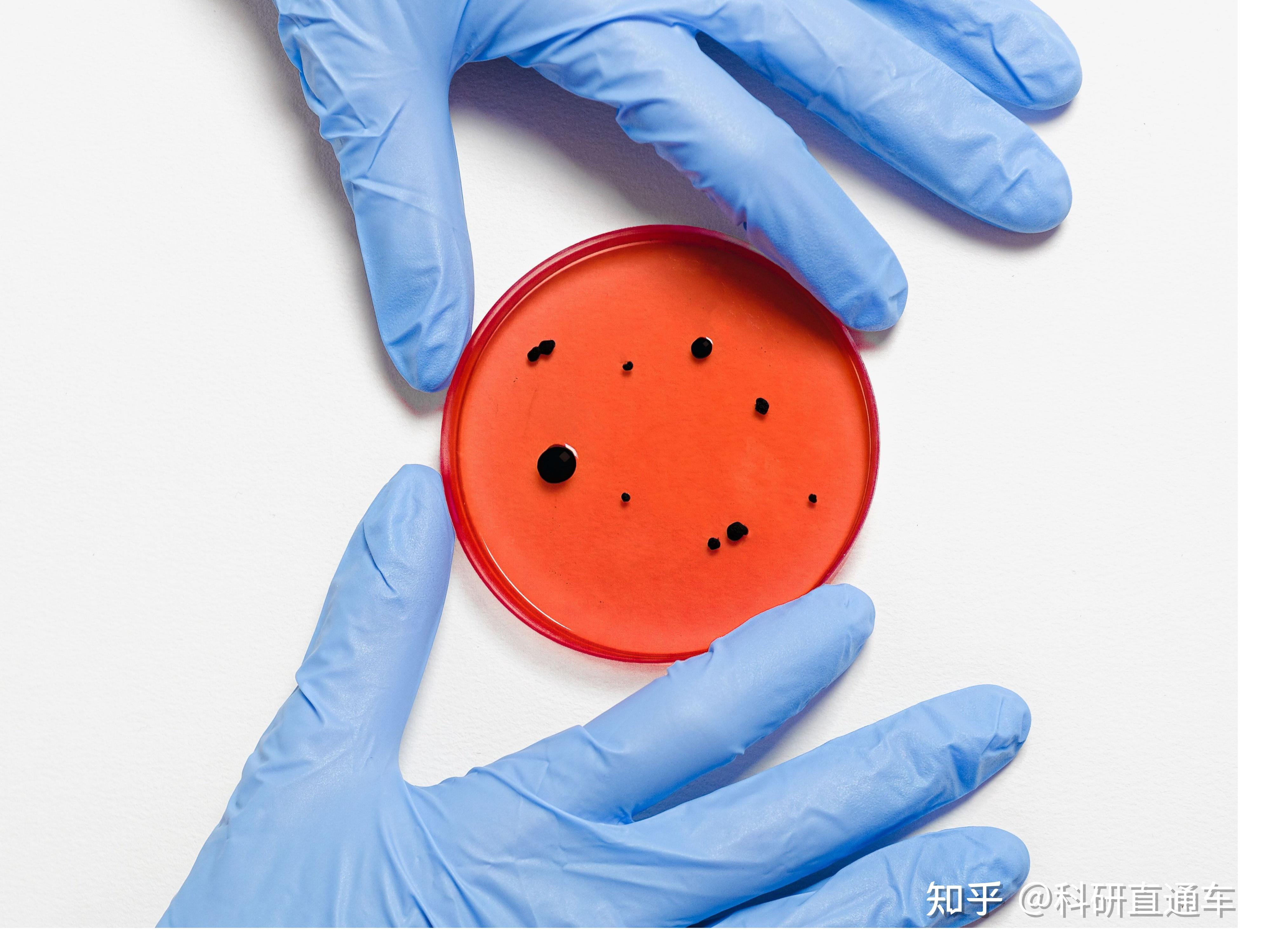 研究前沿｜逆转耐药 提高化疗敏感性！Adv. Mater：可转化的ECM剥夺系统有效抑制肾细胞癌 - 知乎