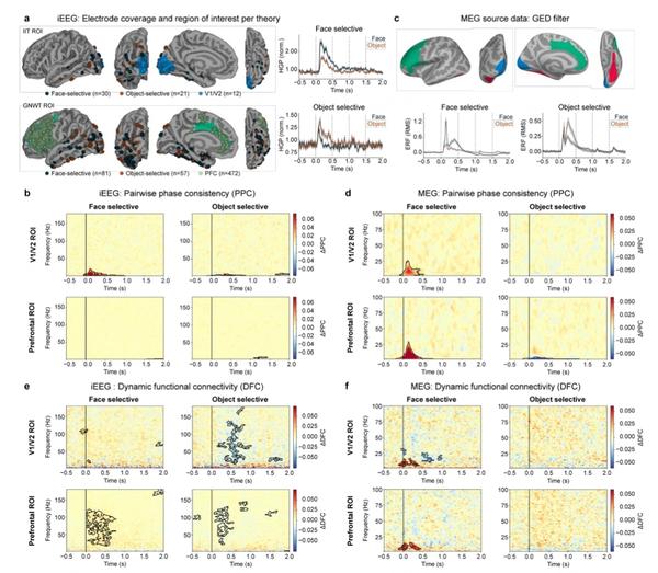 IIT vs GNWT：意识理论对比检验 - 知乎