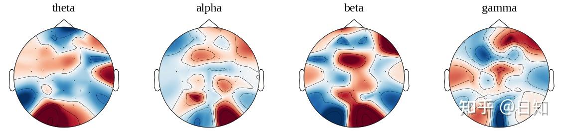 TorchEEG —— 基于 PyTorch 的模块化脑电分析 - 知乎