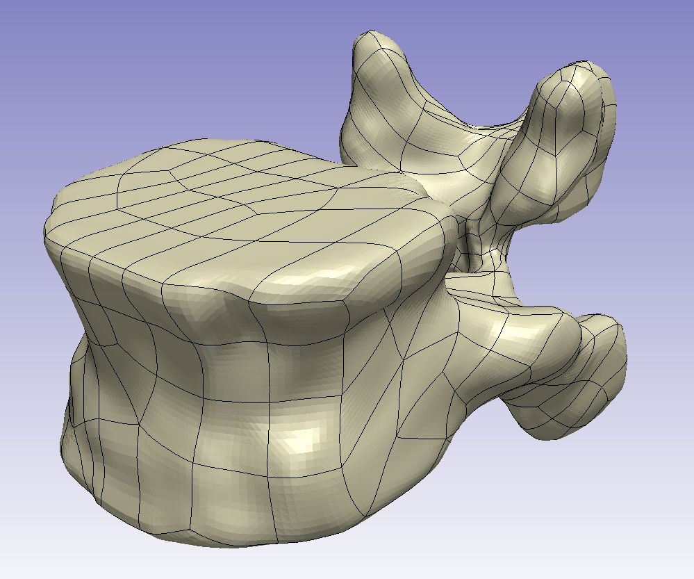 【Simpleware 教程】由图像数据创建 NURBS CAD 模型 - 知乎
