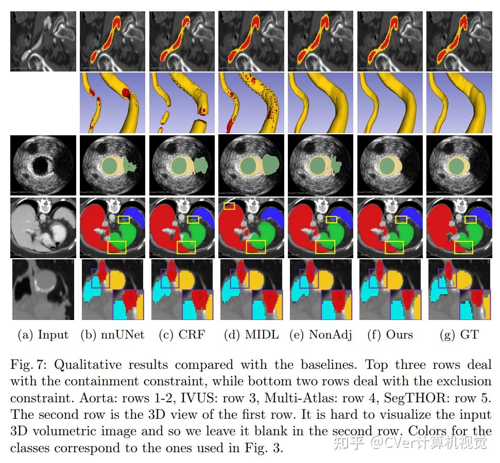 ECCV 2022 Oral | 学习多类别医学图像分割的拓扑交互 - 知乎