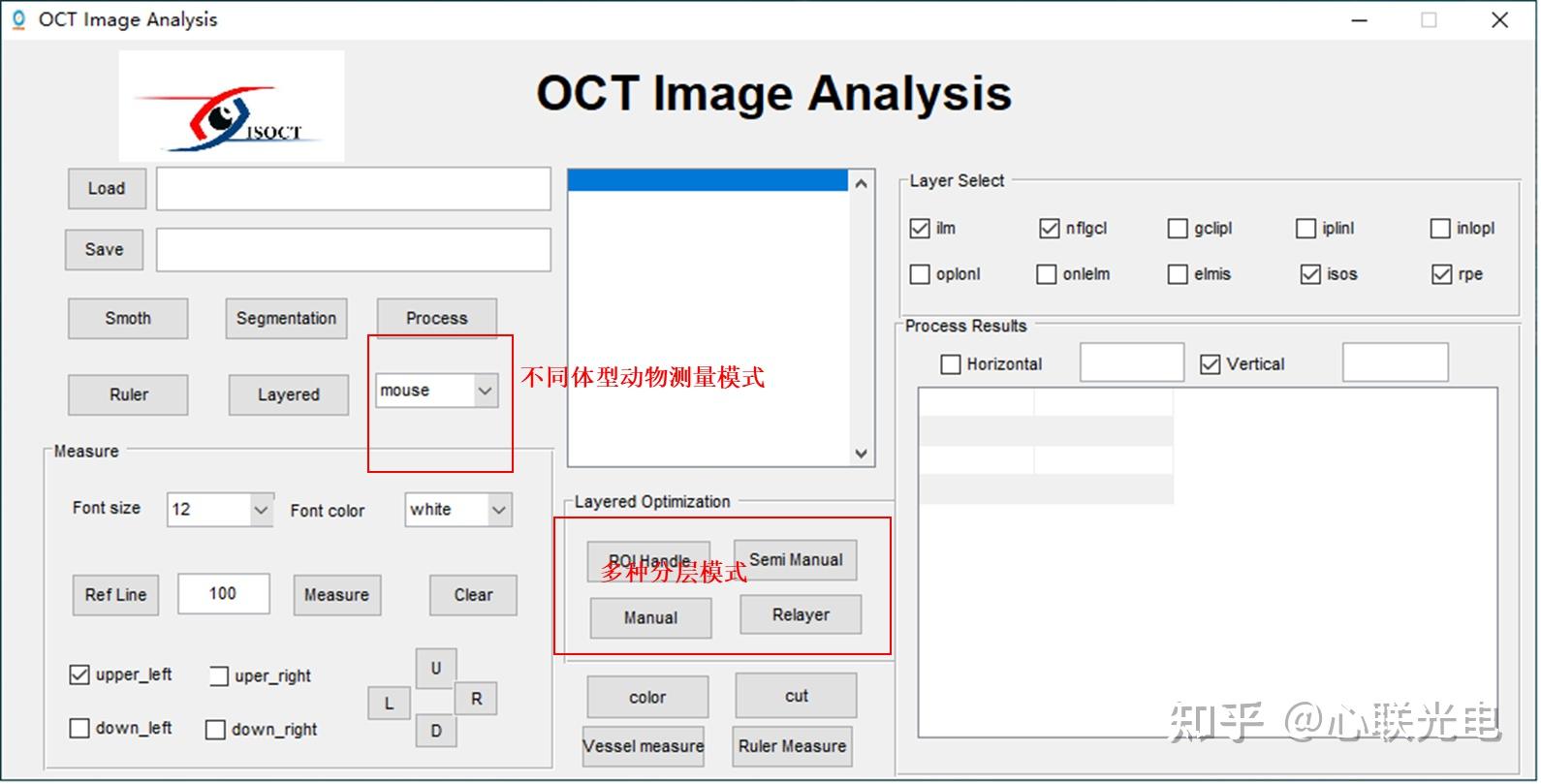 小动物眼轴及前节oct一体化成像系统 - 知乎