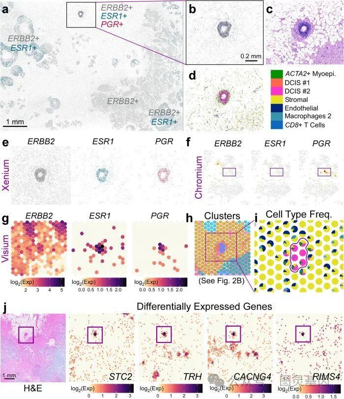 Nat Comm | 10x Genomics团队用单细胞、空间和原位分析技术联合绘制高分辨率肿瘤微环境图谱 - 知乎