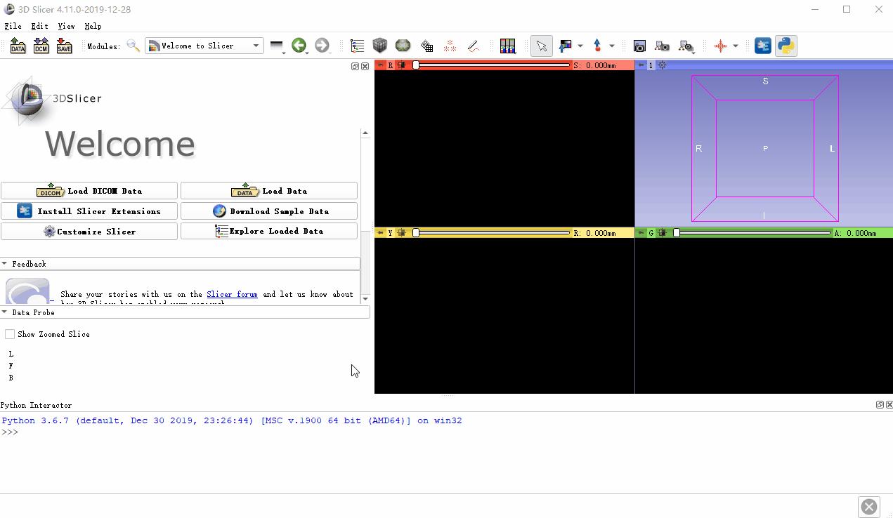 3D Slicer——选择感兴趣区，输出为DICOM序列 - 知乎