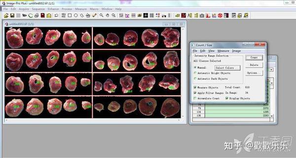 基础医学实验：TTC染色详细计算分析过程，步骤详解（组图） - 知乎