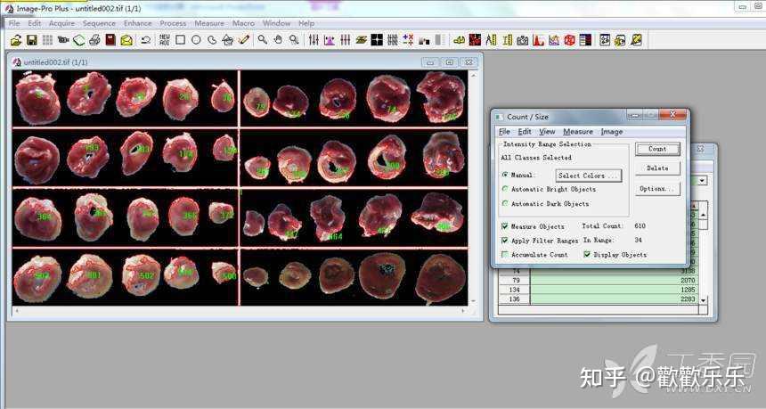 基础医学实验：TTC染色详细计算分析过程，步骤详解（组图） - 知乎