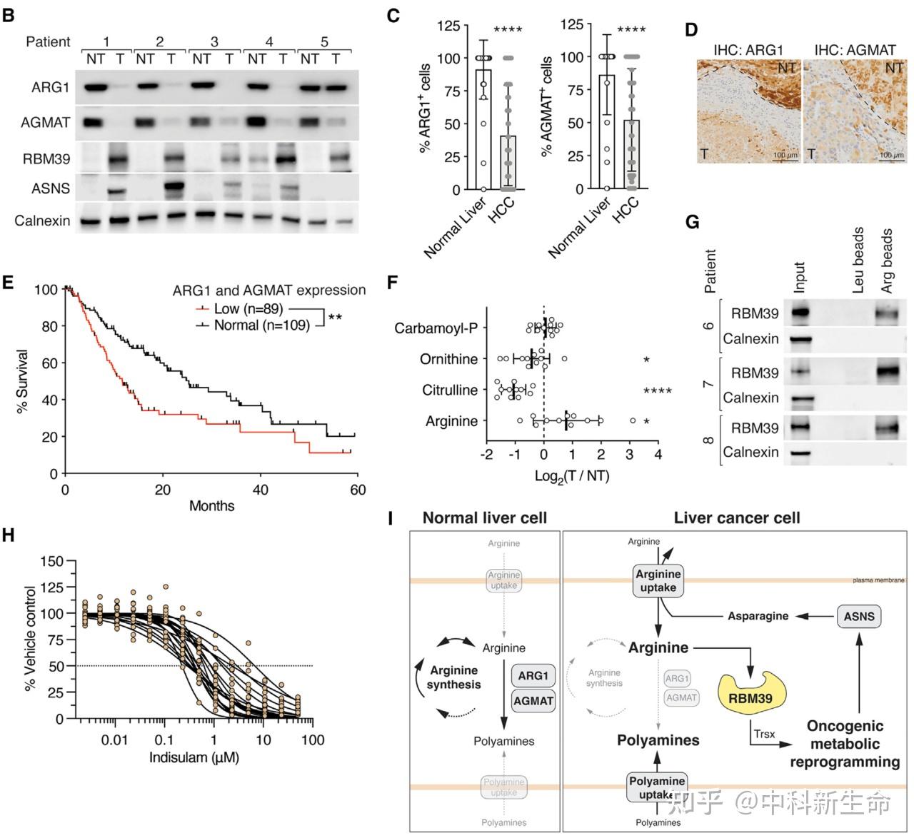 Cell (IF 64.5) | 精氨酸通过RBM39重新编程肝癌中的代谢 - 知乎