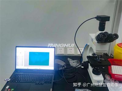 荧光显微镜UB203i-FL应用于真菌检测 - 知乎