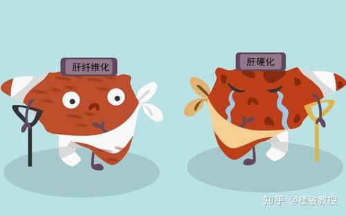 代偿期和失代偿期肝硬化之间有何区别,中医应该如何治疗? 知乎