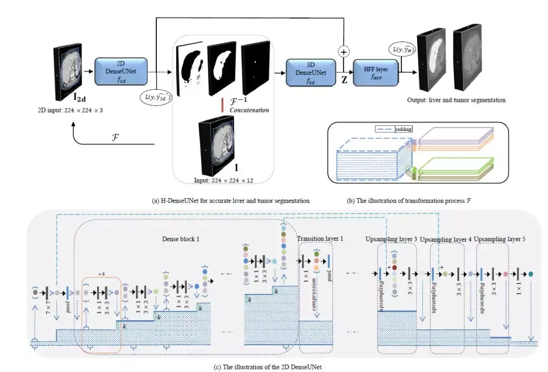 学术分享 | 肝脏肿瘤CT影像优化分割方法-混合密集连接UNet(H-Dense UNet)网络 - 知乎