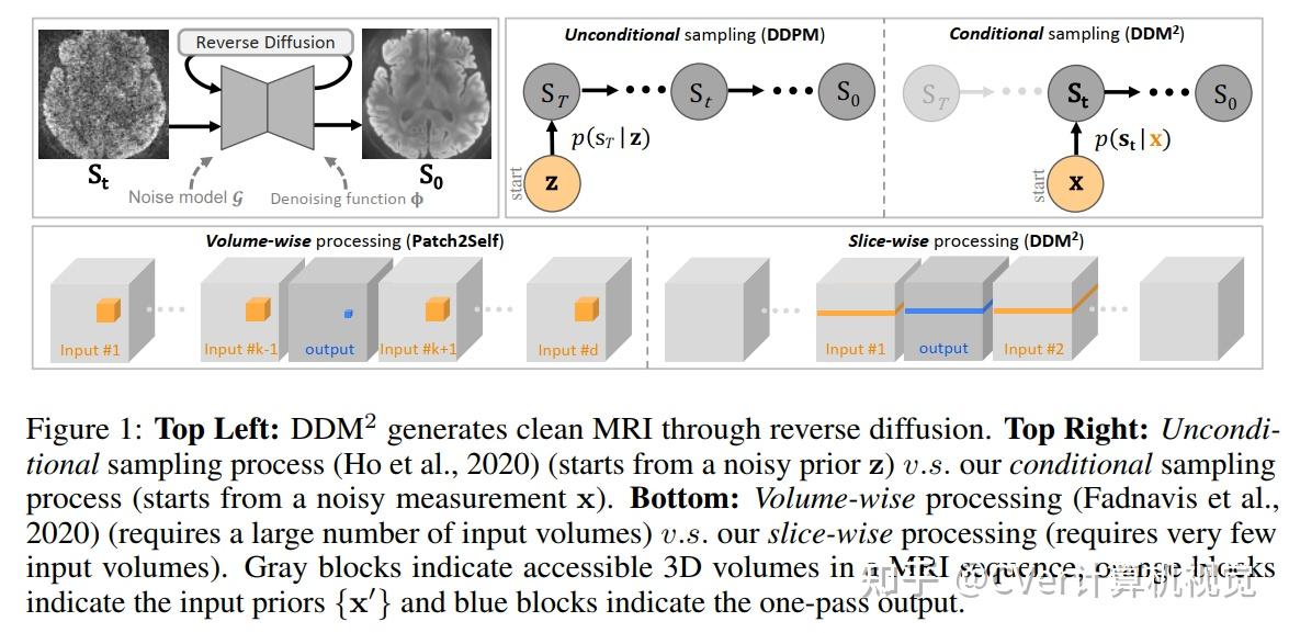 ICLR 2023 | 斯坦福提出DDM2：基于生成扩散模型的自监督扩散MRI去噪 - 知乎