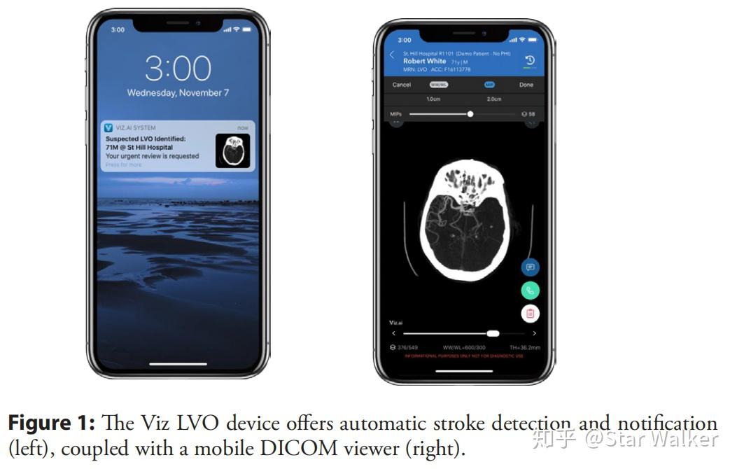 每例1040美元，Viz LVO软件能拿到这份补贴可不仅仅只靠AI
