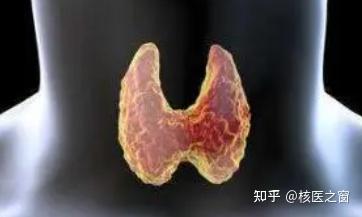 甲状腺摄131I试验的原理与临床应用 - 知乎