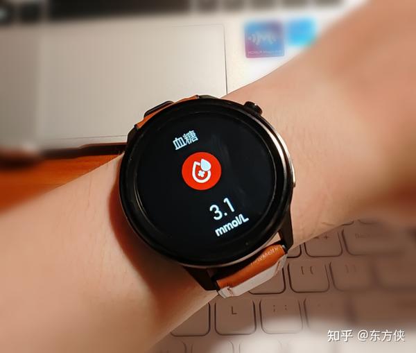 dido E55 Pro远程版智能手表深度评测：无创血糖，守护健康 - 知乎