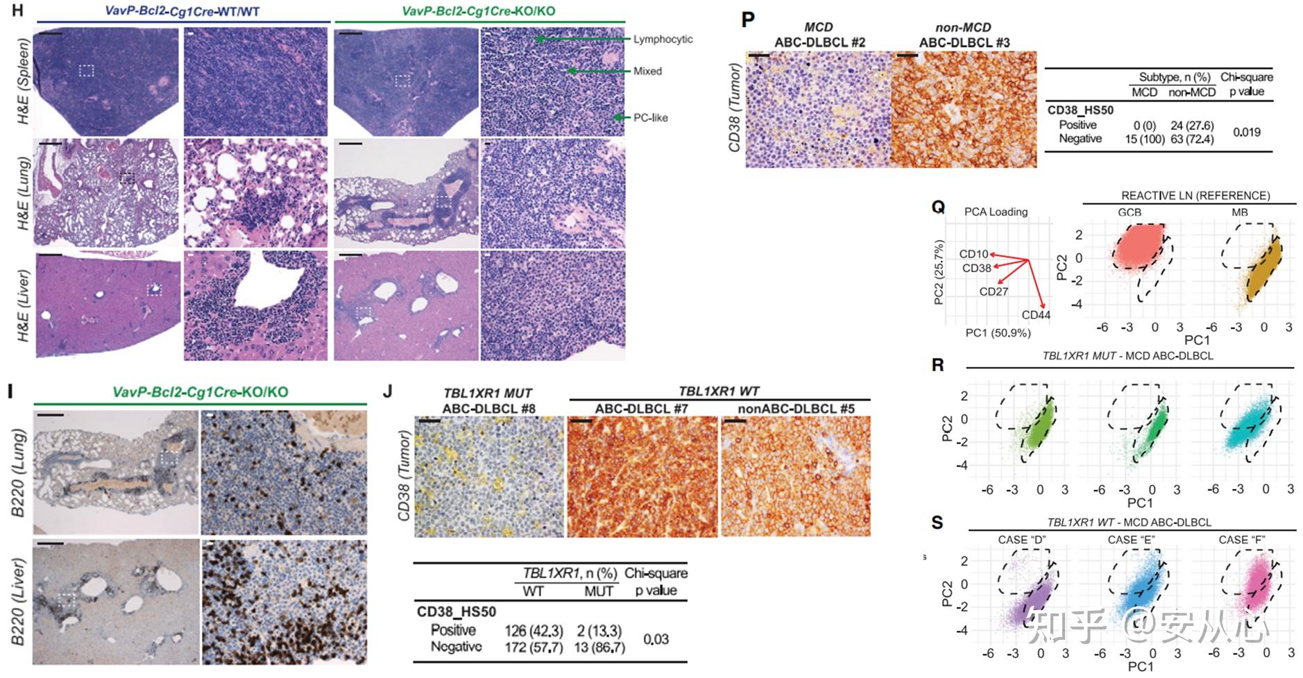 TBL1XR1突变通过诱导促肿瘤程序驱动结外淋巴瘤 - 知乎