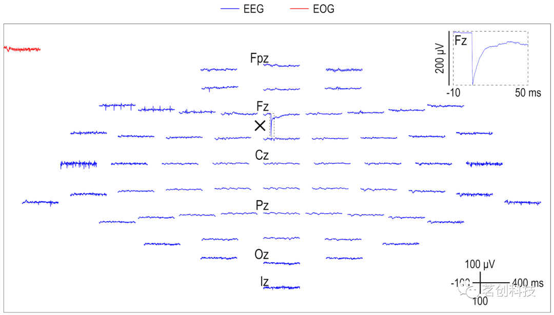 rt-TEP工具：实时显示TMS诱发电位，最大化皮层激活和最小化伪影 - 知乎