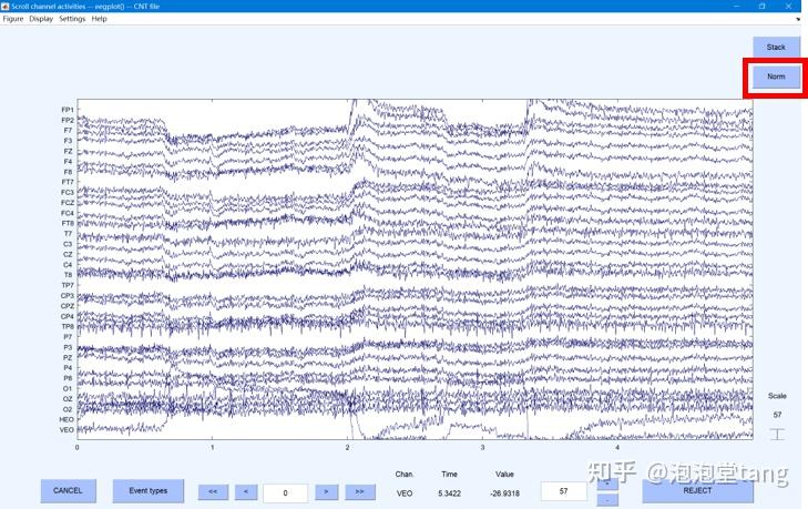 基于eeglab的脑电数据预处理 - 知乎