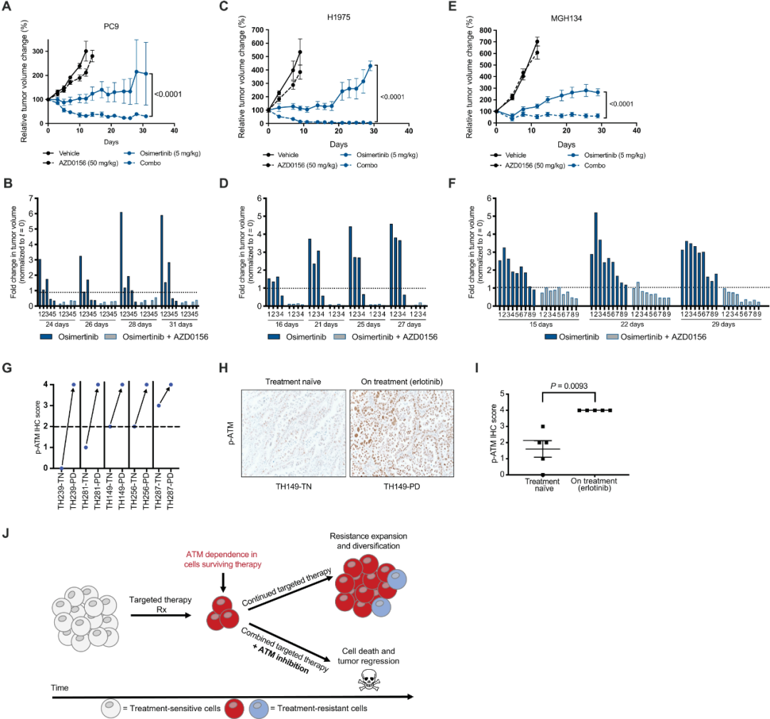 STM | ATM激酶抑制剂干扰肿瘤细胞DNA双链断裂修复 - 知乎