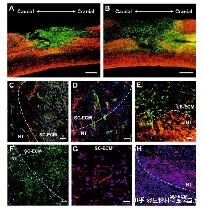 脱细胞基质（ECM）水凝胶在体内的应用与发展 - 知乎