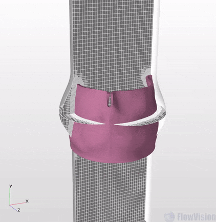 FlowVision在心脑血管生物力学CFD仿真分析的应用 - 知乎