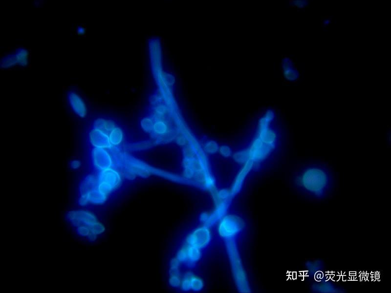 显微镜能怎样看细菌？ - 知乎