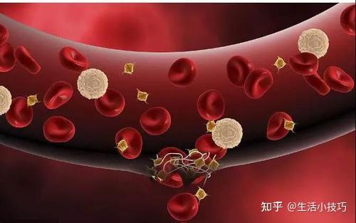 女性应该如何调理血瘀导致的月经量多、经期延长的问题呢？ 知乎