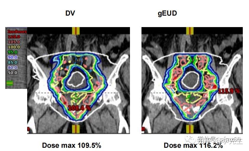 学习gEUD，用好gEUD（第二篇）。 - 知乎