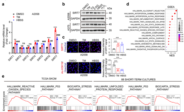 STTT︱空军军医大学李春英团队揭示长寿基因家族成员SIRT7在黑色素瘤发展和免疫逃逸中的作用和机制 - 知乎