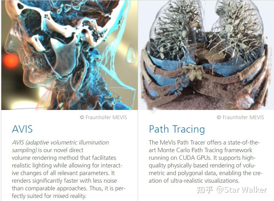 透过MeVisLab，看看德国医疗影像研究所的技术转化之桥