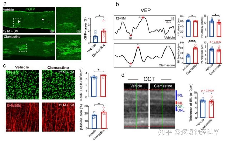 J Neurosci︱梅峰/叶剑课题组揭示老化过程中少突胶质细胞更替不足是导致视神经轴突退化和视功能下降的重要原因 - 知乎