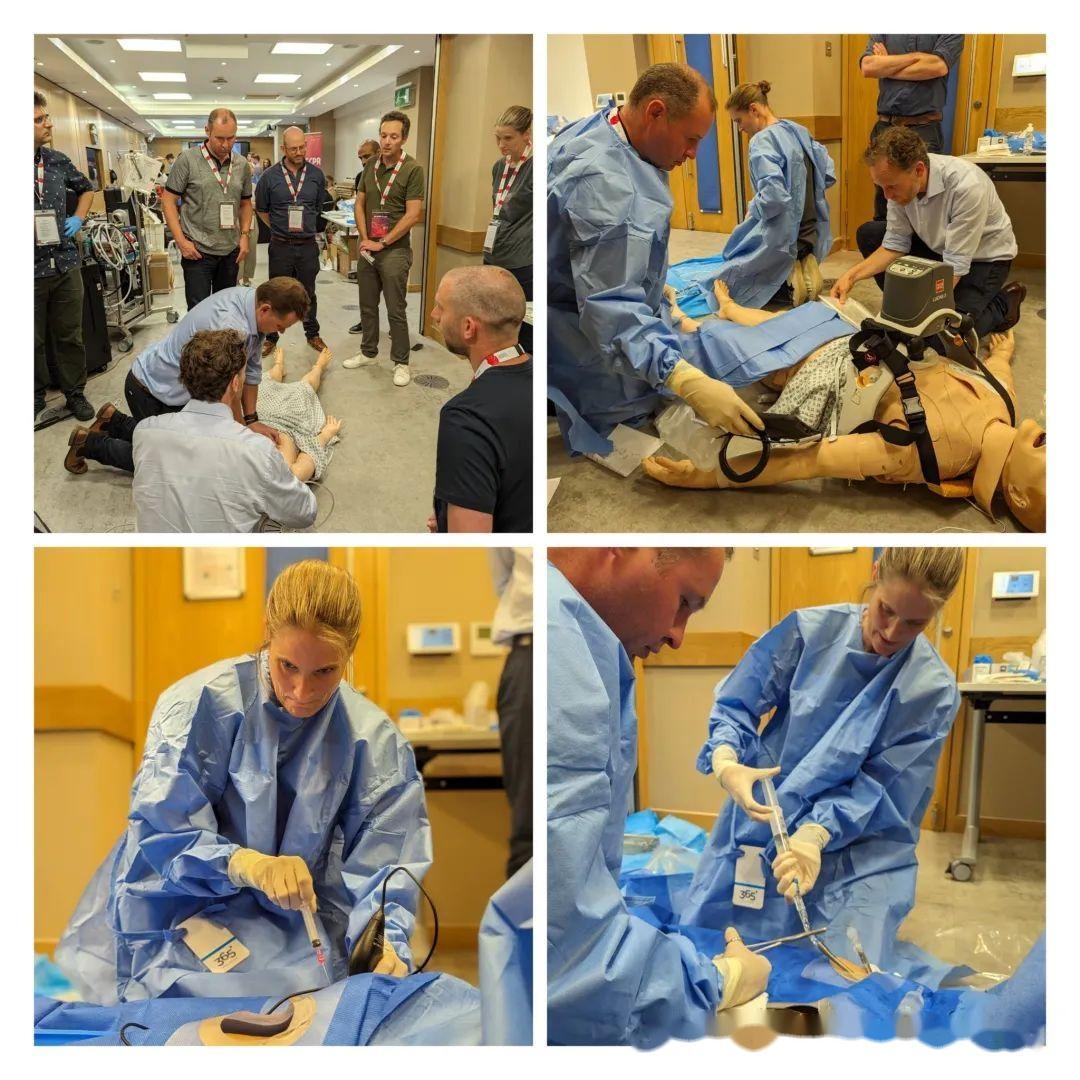 ECMO，最通俗易懂的总结！ - 知乎