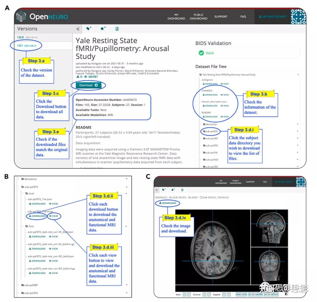 关于开源神经影像数据集如何使用的协议 - 知乎