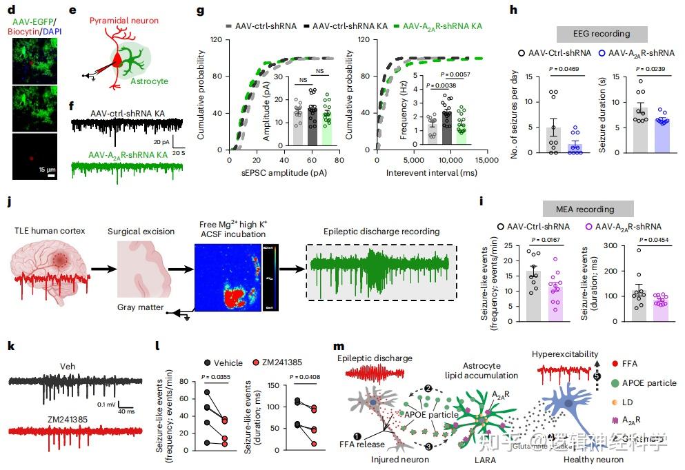 专家点评 Nat Neurosci︱突破！南京大学闫超团队揭示脂质堆积的反应性星形胶质细胞促进癫痫疾病进展 - 知乎