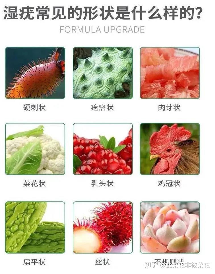 “尖锐湿疣”初期有啥明显症状?有疼痛感吗? 知乎