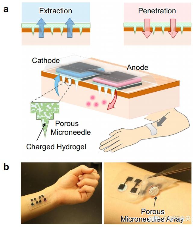 透皮电渗流由多孔微针阵列贴片产生 - 知乎